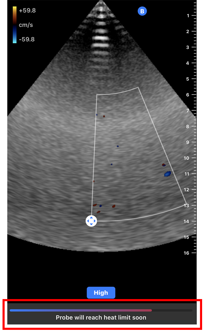Troubleshooting Overheating Probe – Butterfly Network